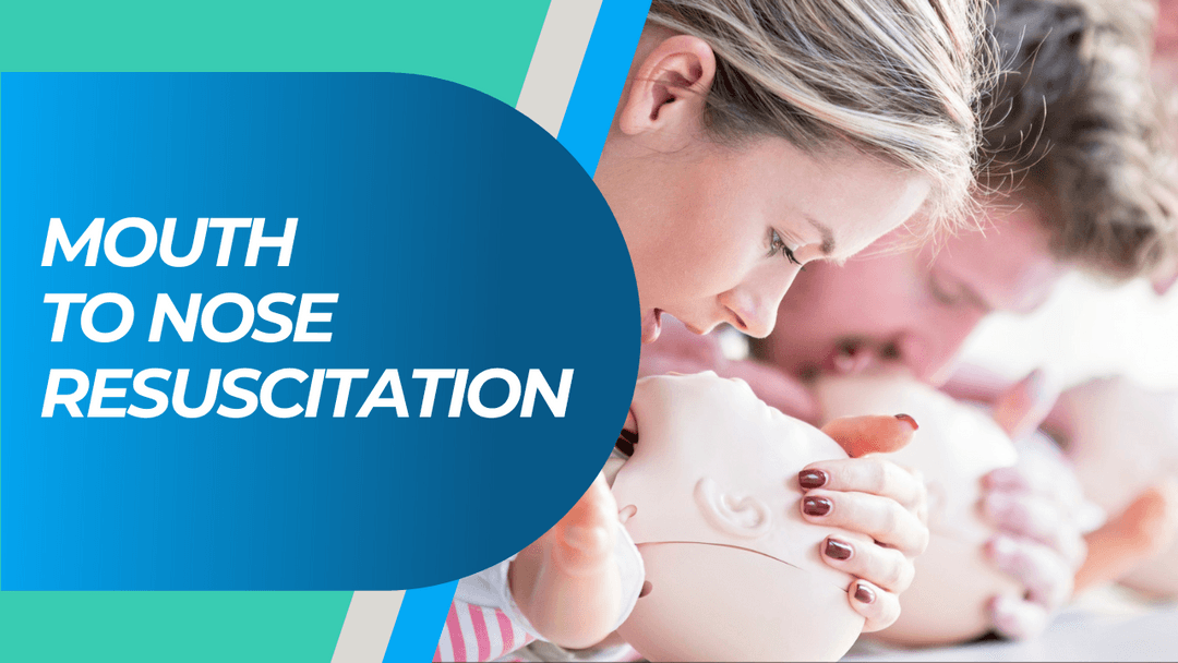 Mouth-to-Nose Resuscitation: Effective Techniques and Step-by-Step Guide